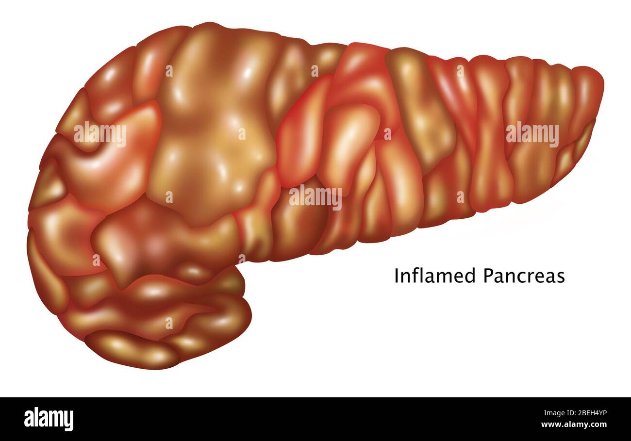 Pancreas illustration hi-res stock photography and images - Alamy