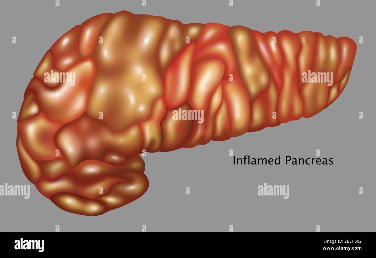 Pancreas organ digestive system endocrine hi-res stock photography and ...