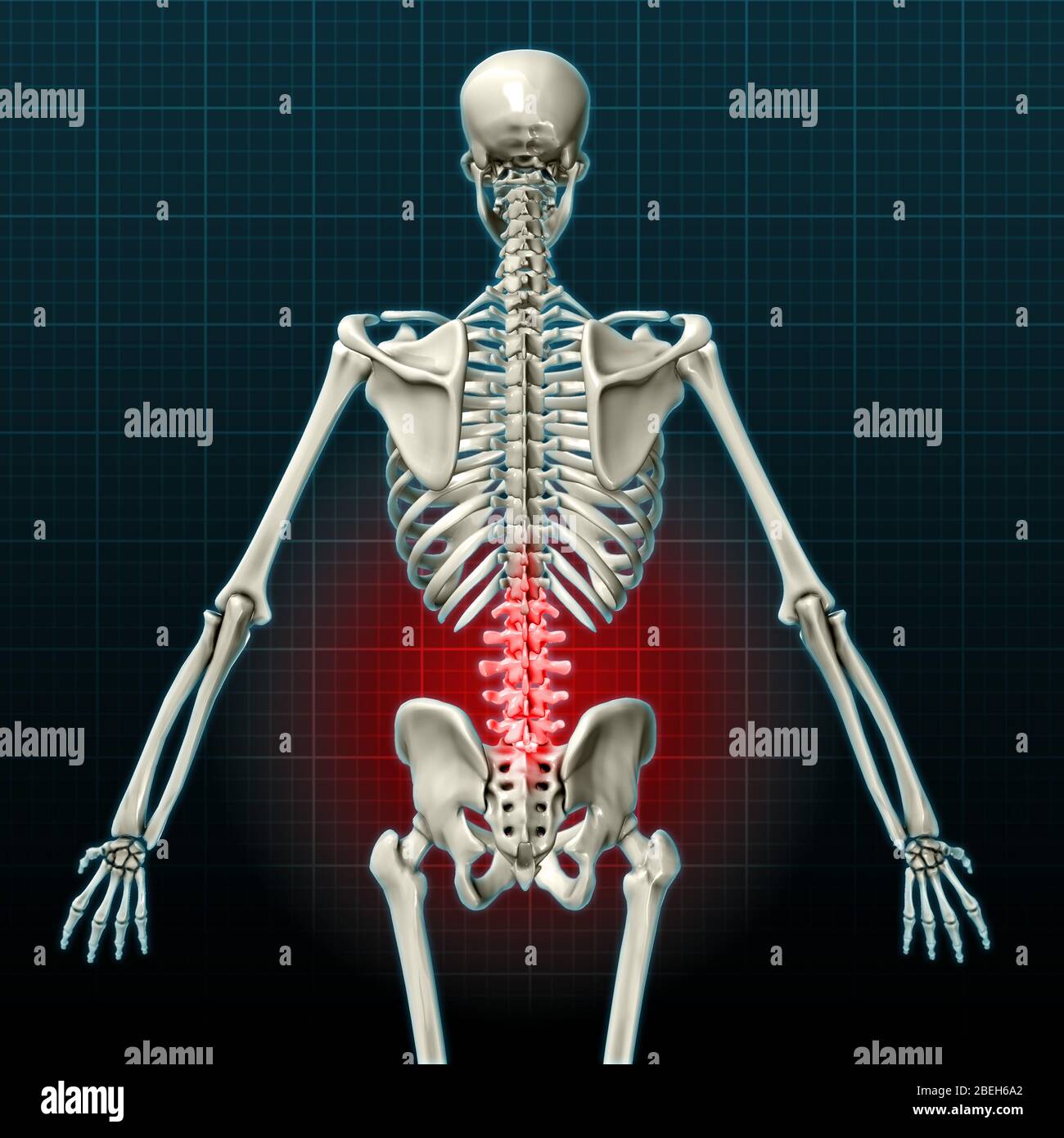 Lower Back Pain, Illustration Stock Photo - Alamy