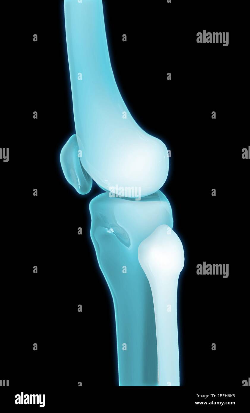 Knee Bones, Lateral View Stock Photo - Alamy