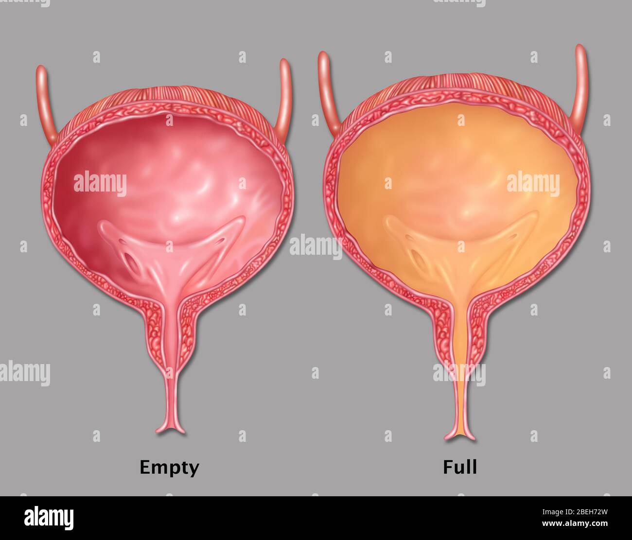 Empty and Full Female Bladder, Illustration Stock Photo - Alamy