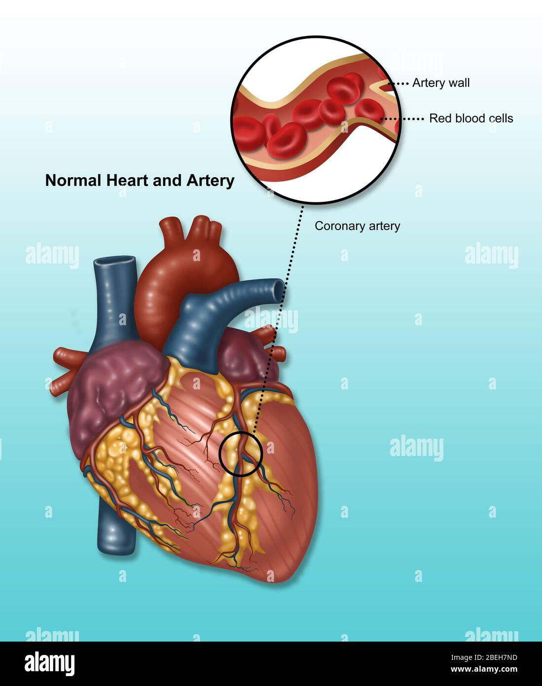 Left circumflex artery hi-res stock photography and images - Alamy