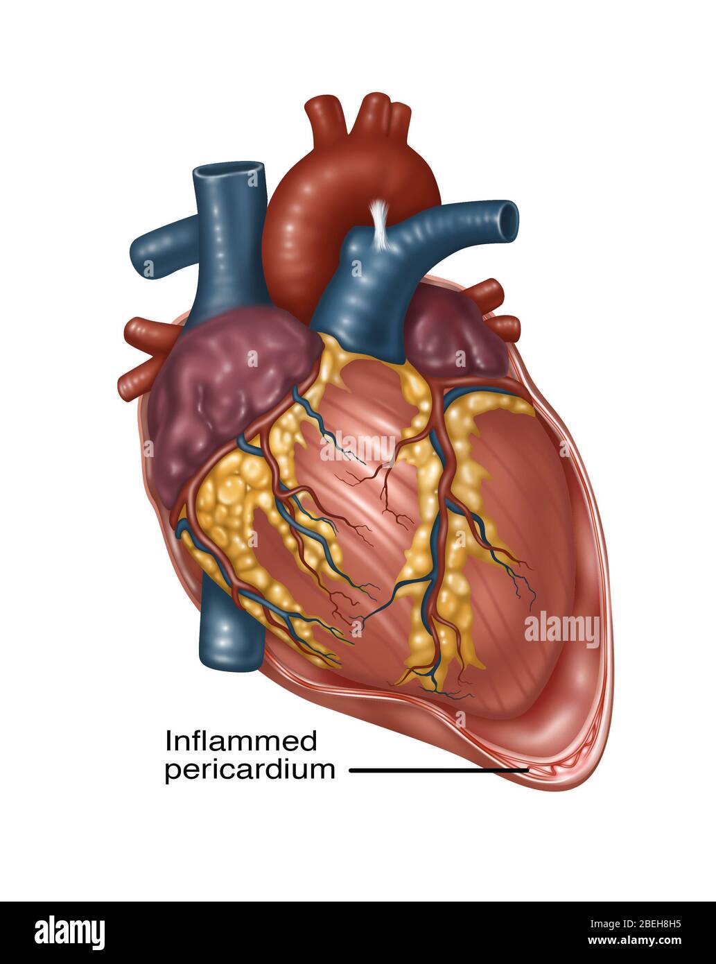 Human Pericardium