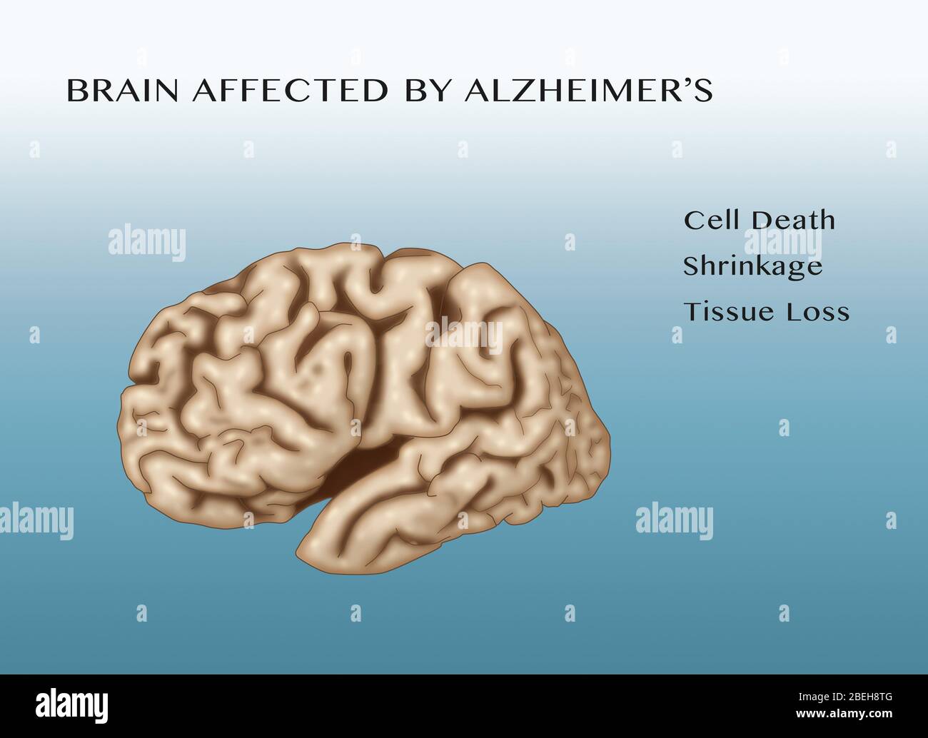 Was affected hi-res stock photography and images - Alamy