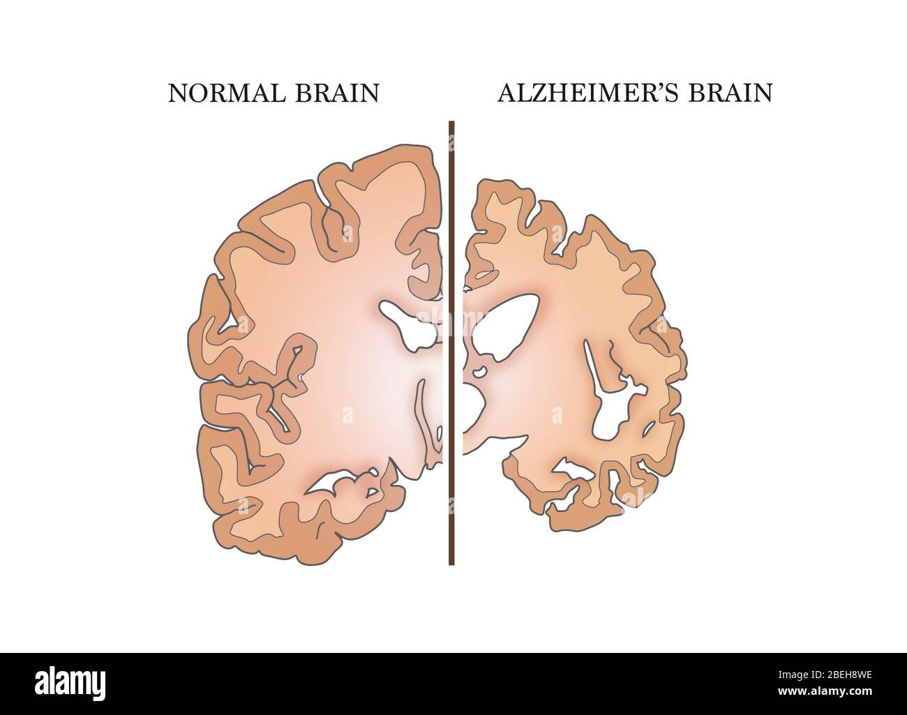 Brain ventricles Cut Out Stock Images & Pictures - Alamy