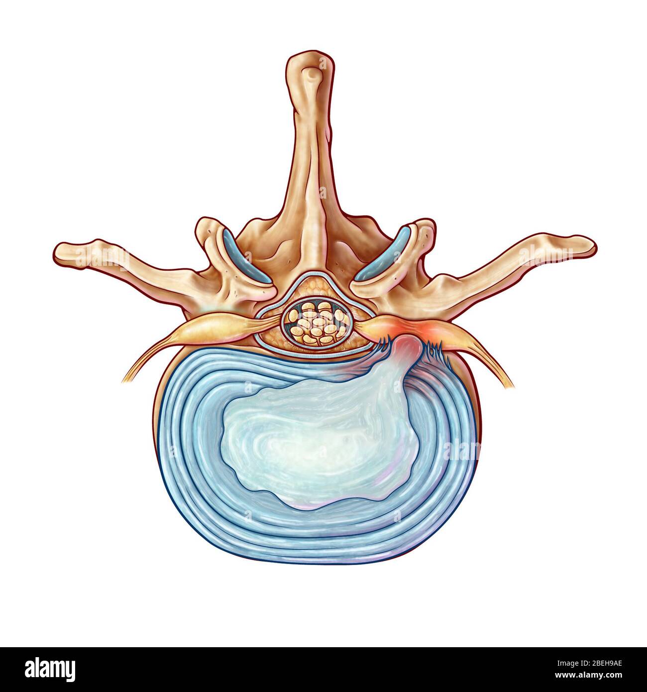 Cauda Equina Cadaver