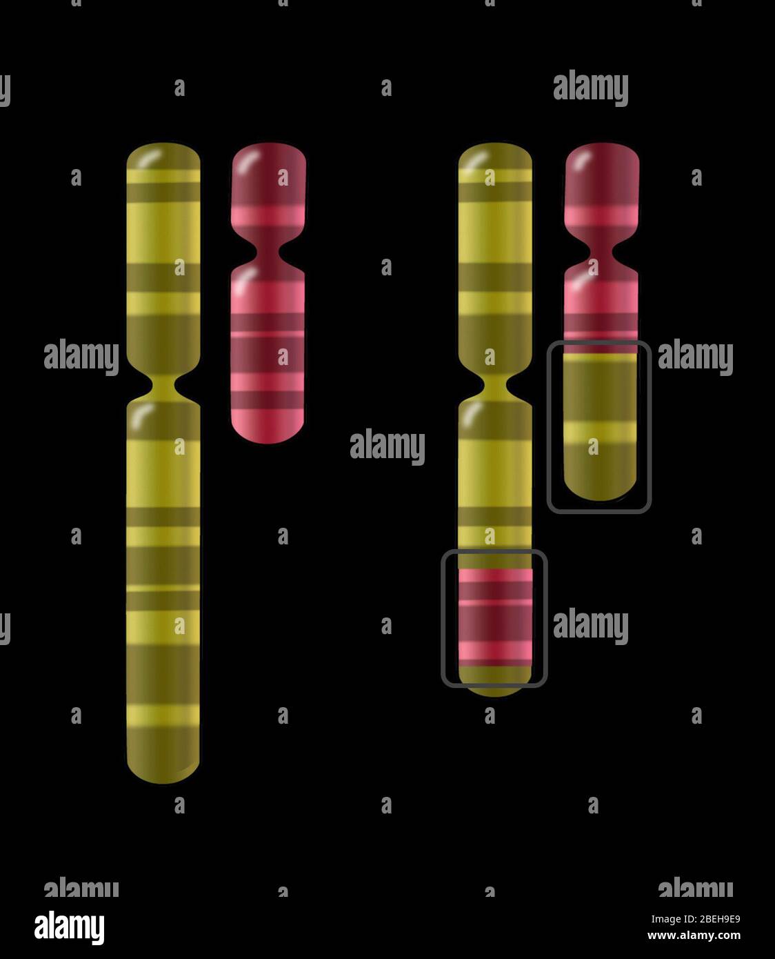 Chromosome translocation hi-res stock photography and images - Alamy Chromosome translocation hi-res stock photography and images - Alamy