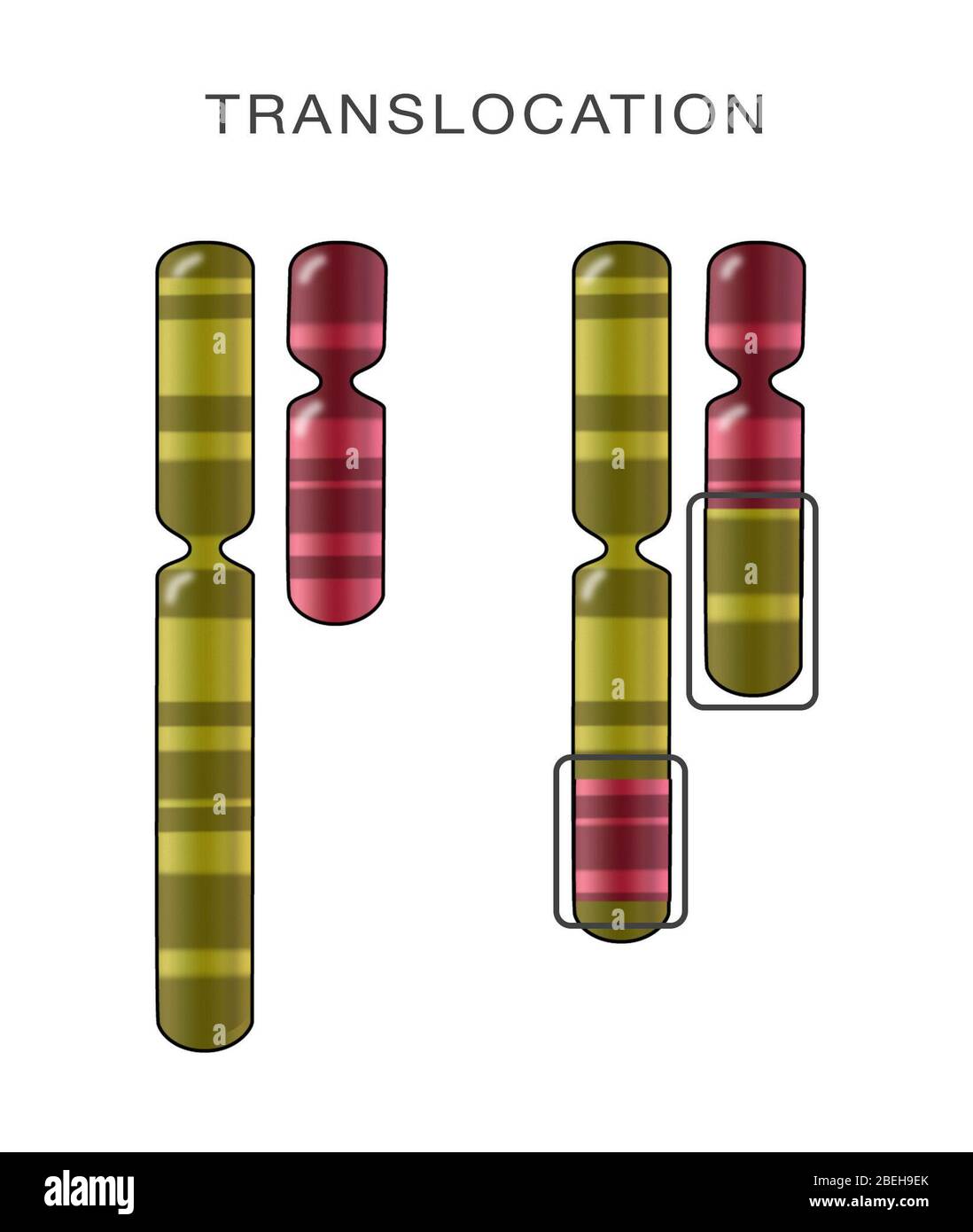 Chromosome translocation High Resolution Stock Photography and Images ... Chromosome translocation High Resolution Stock Photography and Images ...