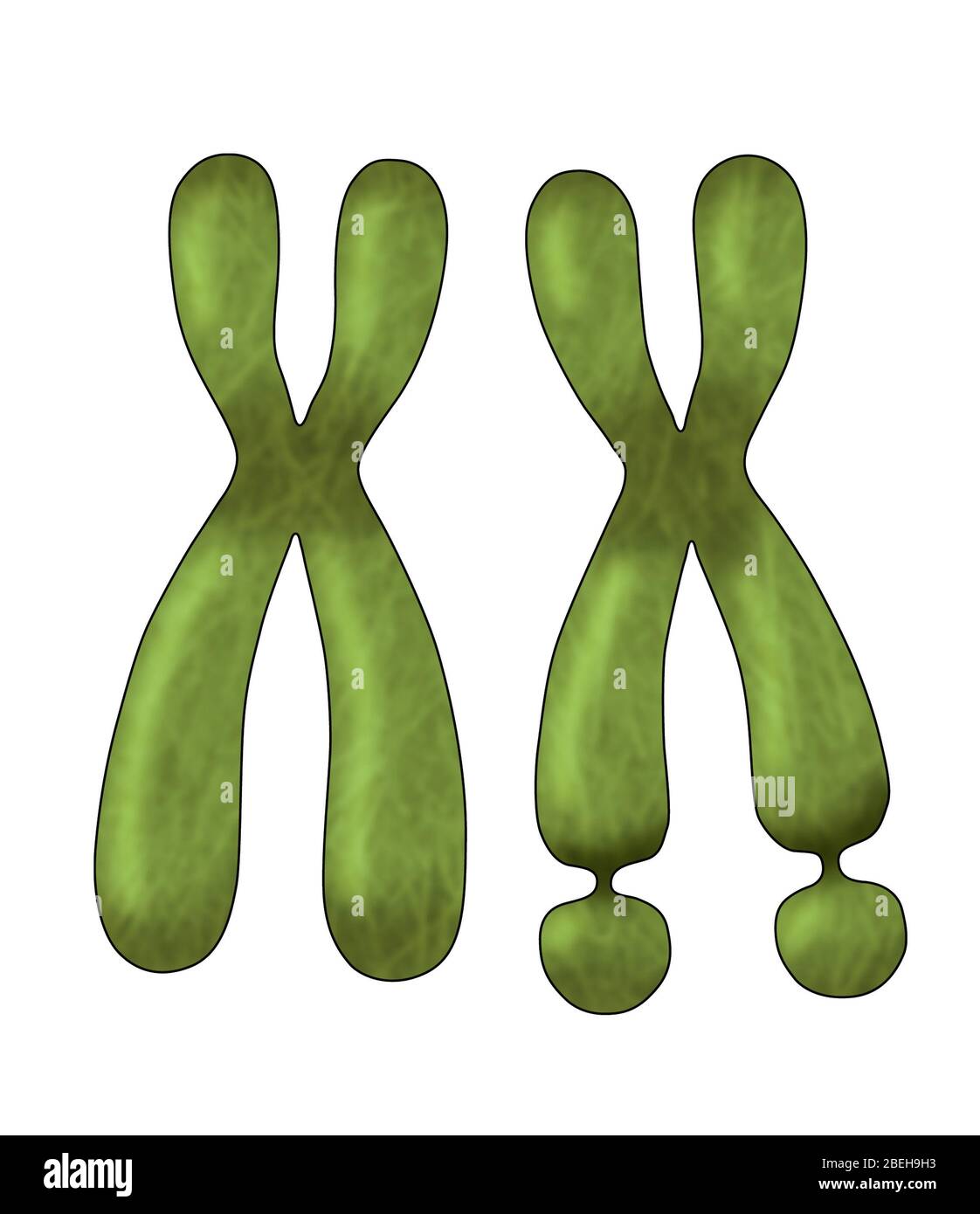Fragile x syndrome hi-res stock photography and images - Alamy