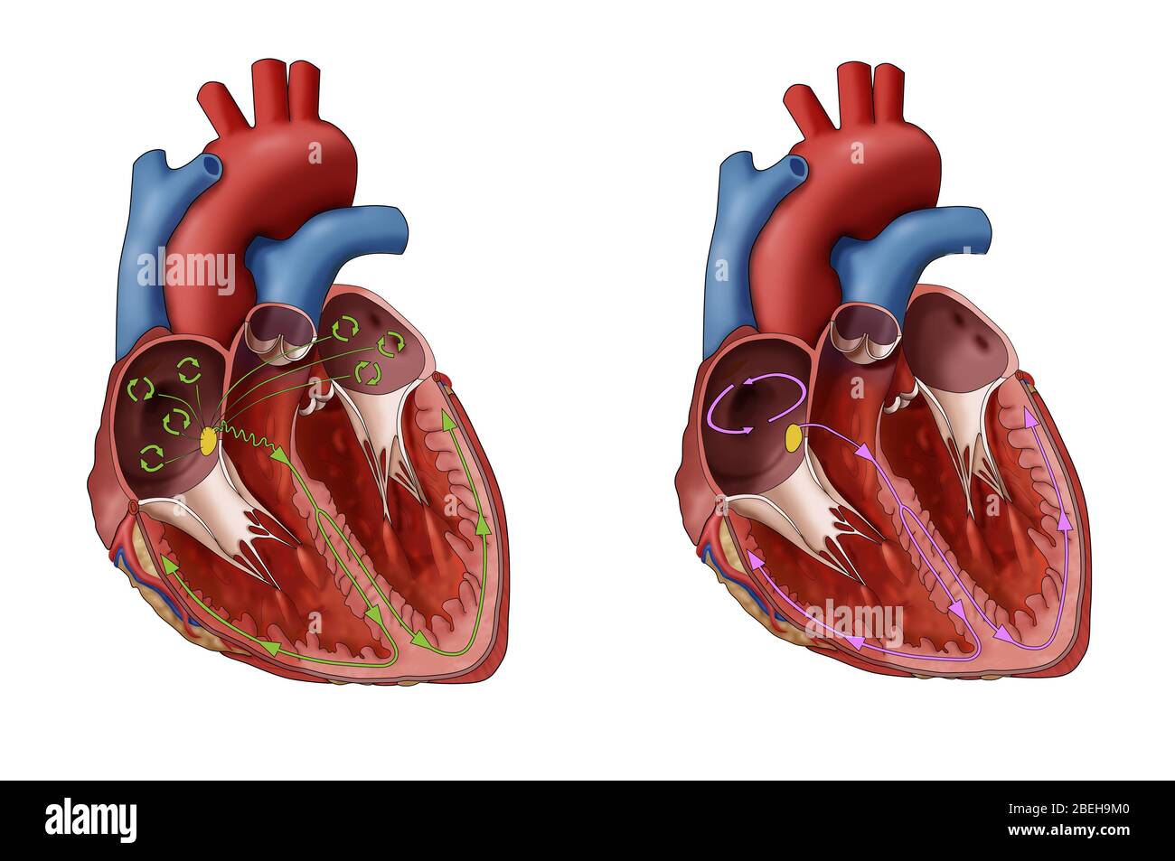 Atrial flutter Cut Out Stock Images & Pictures - Alamy