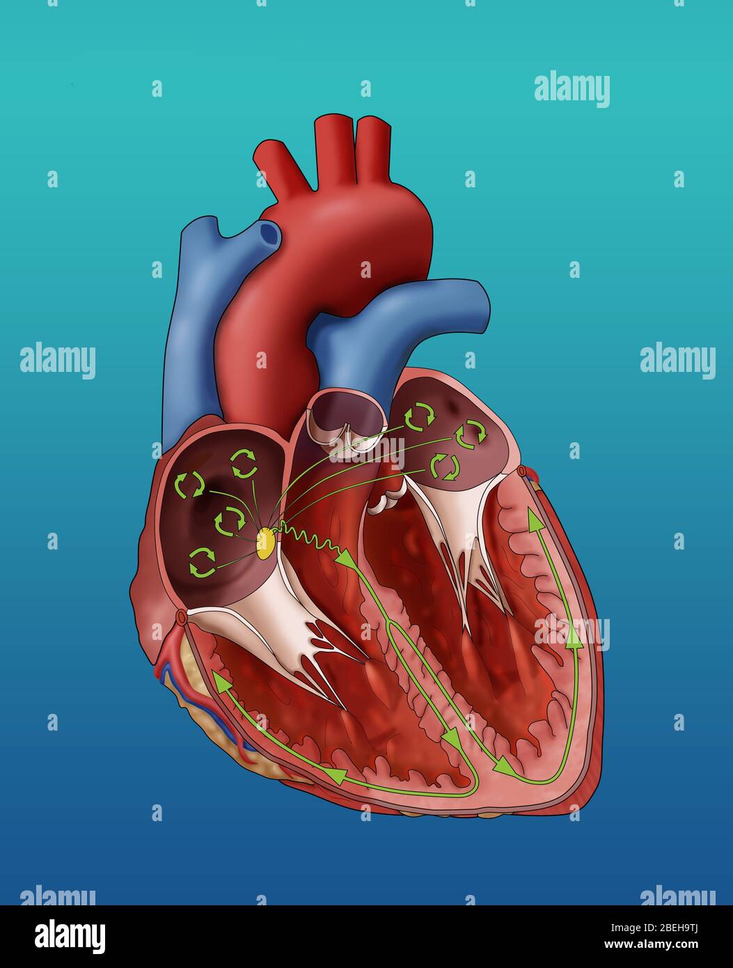 Atrial Fibrillation, Illustration Stock Photo - Alamy