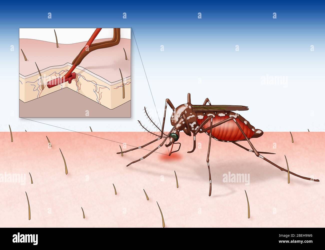Detail of a Mosquito Bite, Illustration Stock Photo - Alamy