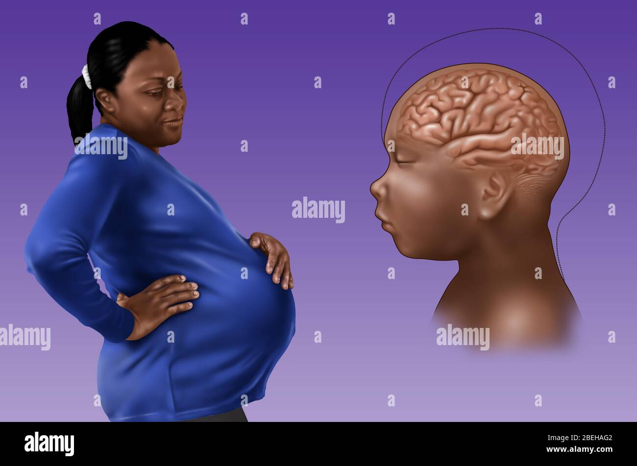 Microcephalic Pinheads