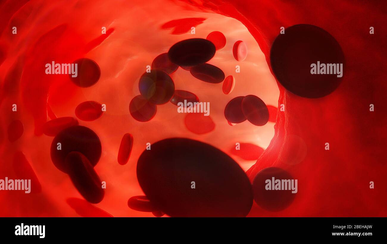 Blood supply hi-res stock photography and images - Alamy