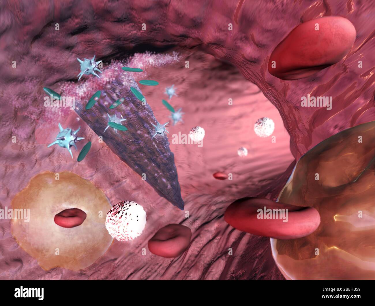 Inflammatory Response, Illustration Stock Photo - Alamy
