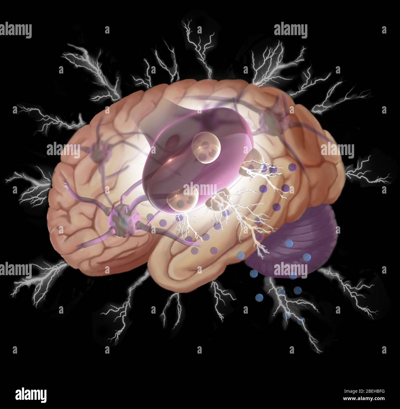 Epileptic brain hi-res stock photography and images - Alamy