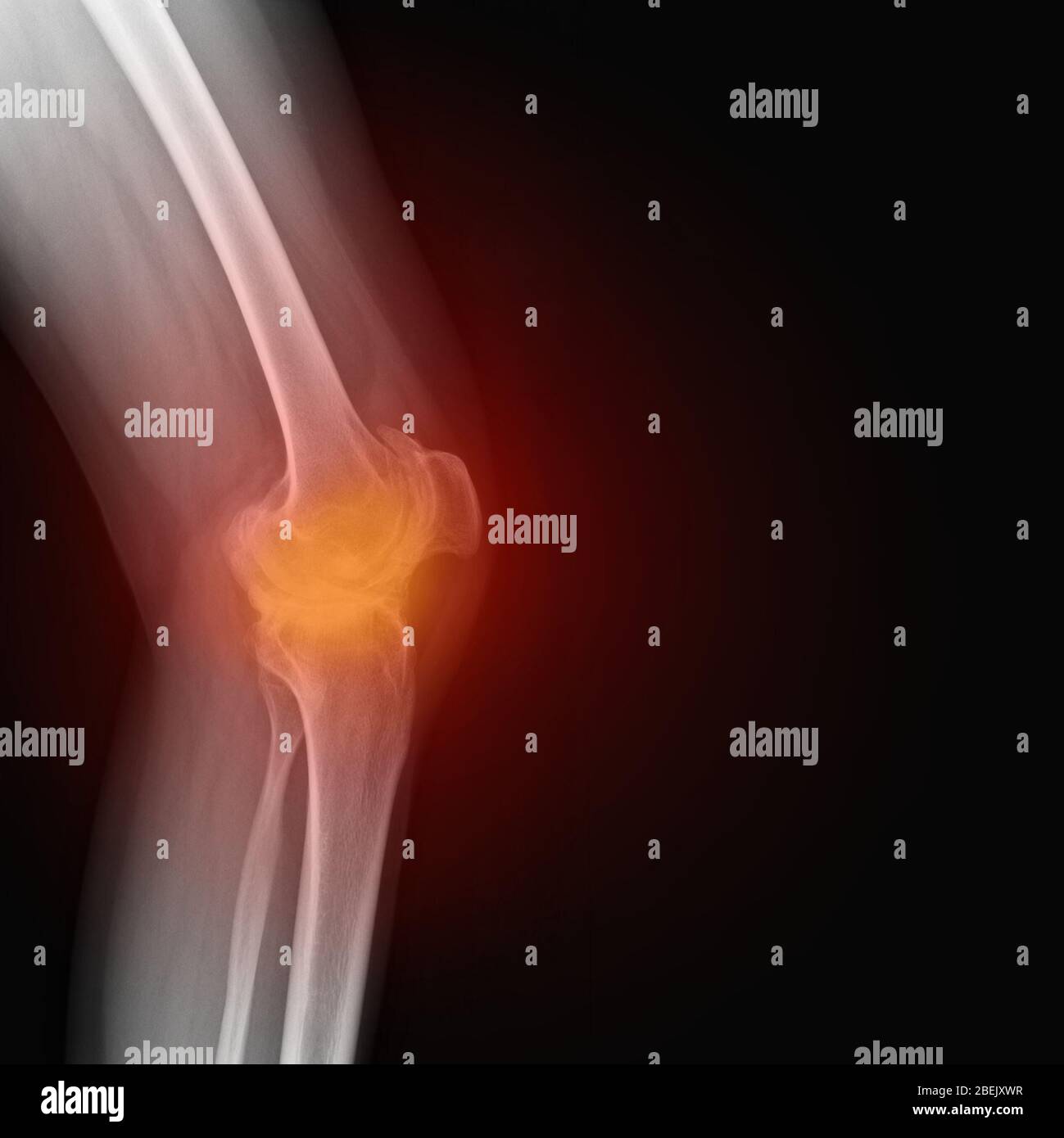 Oa Knee High Resolution Stock Photography and Images - Alamy