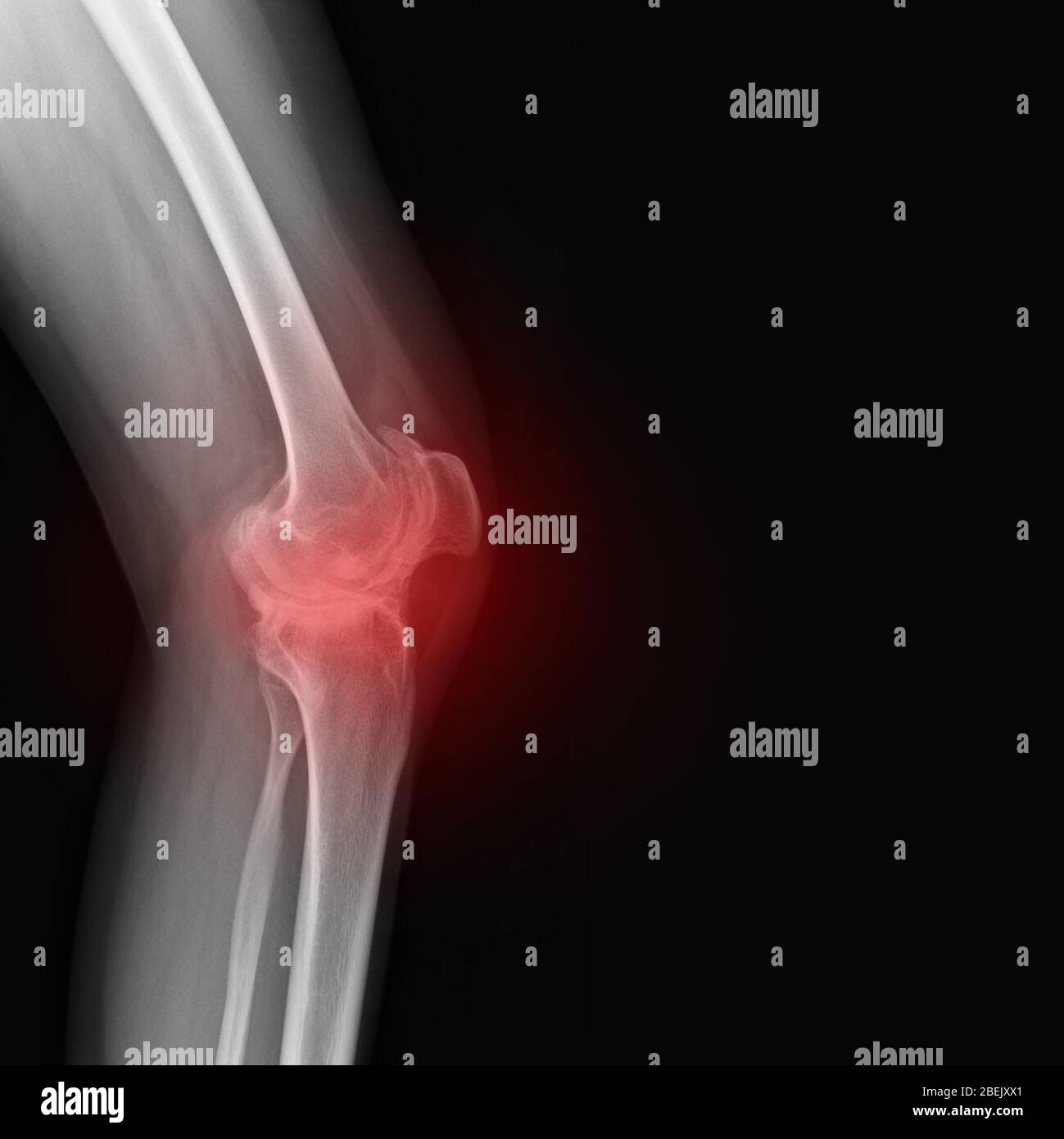 Oa Knee High Resolution Stock Photography and Images - Alamy