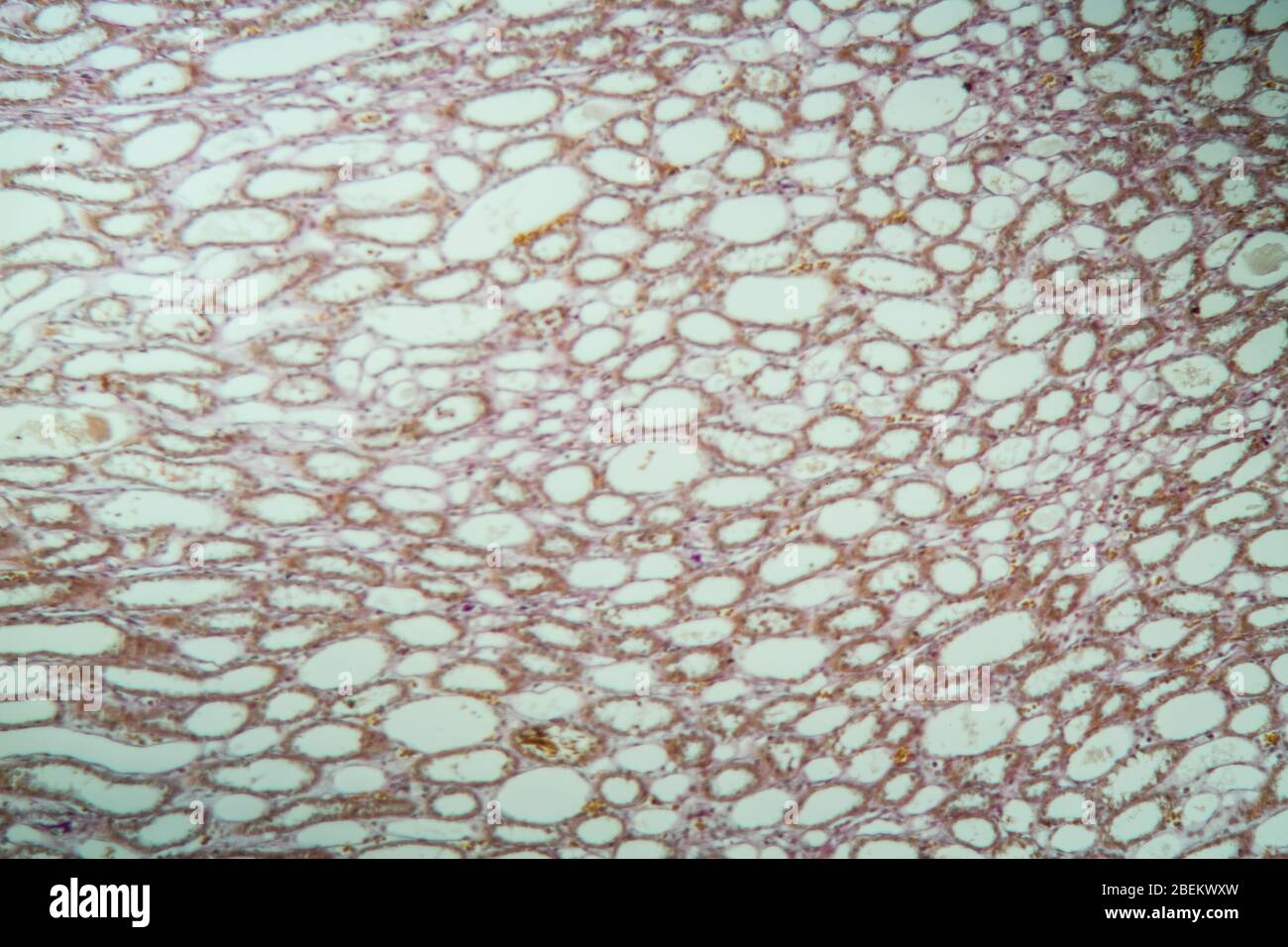healthy lung tissue with alveoli 100x Stock Photo - Alamy