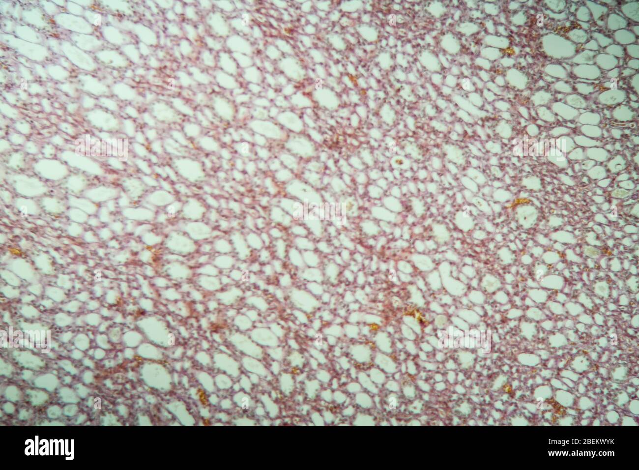 healthy lung tissue with alveoli 100x Stock Photo - Alamy