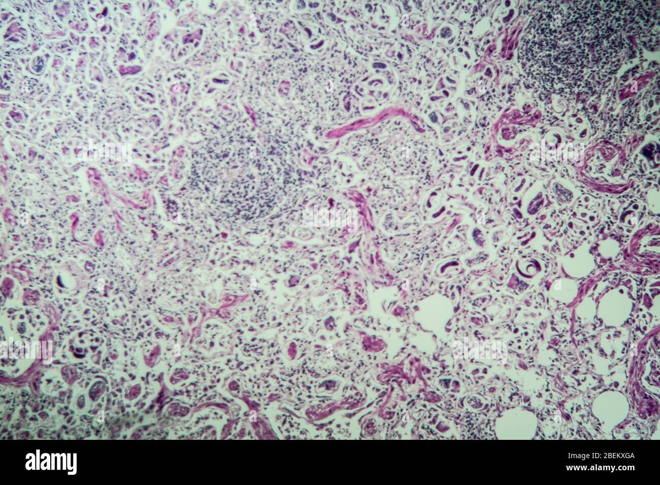 Lungworm under the microscope 100x Stock Photo - Alamy