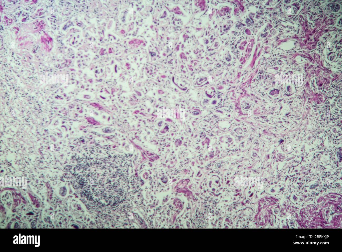 Lungworm under the microscope 100x Stock Photo - Alamy