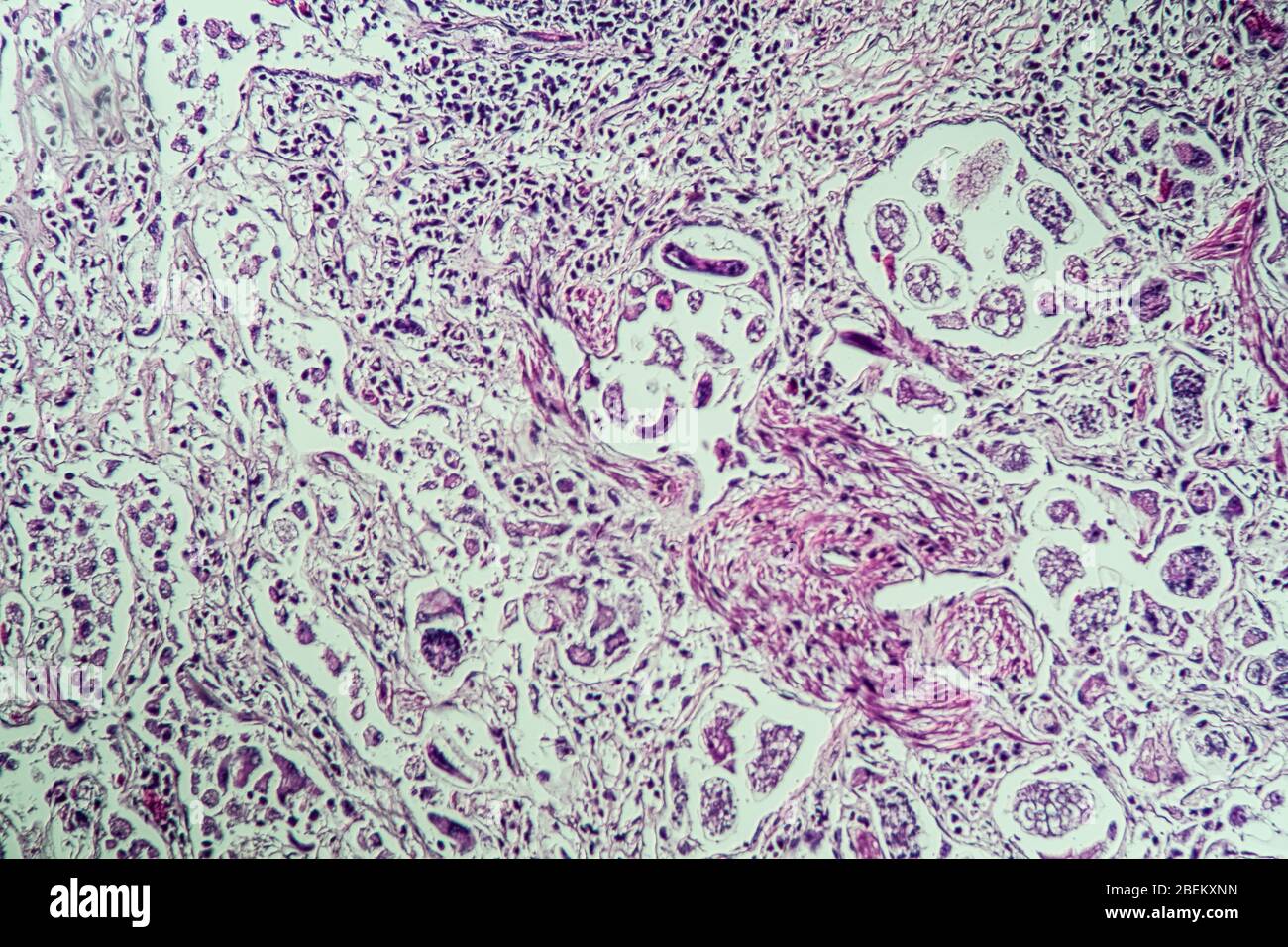 Lungworm under the microscope 100x Stock Photo - Alamy