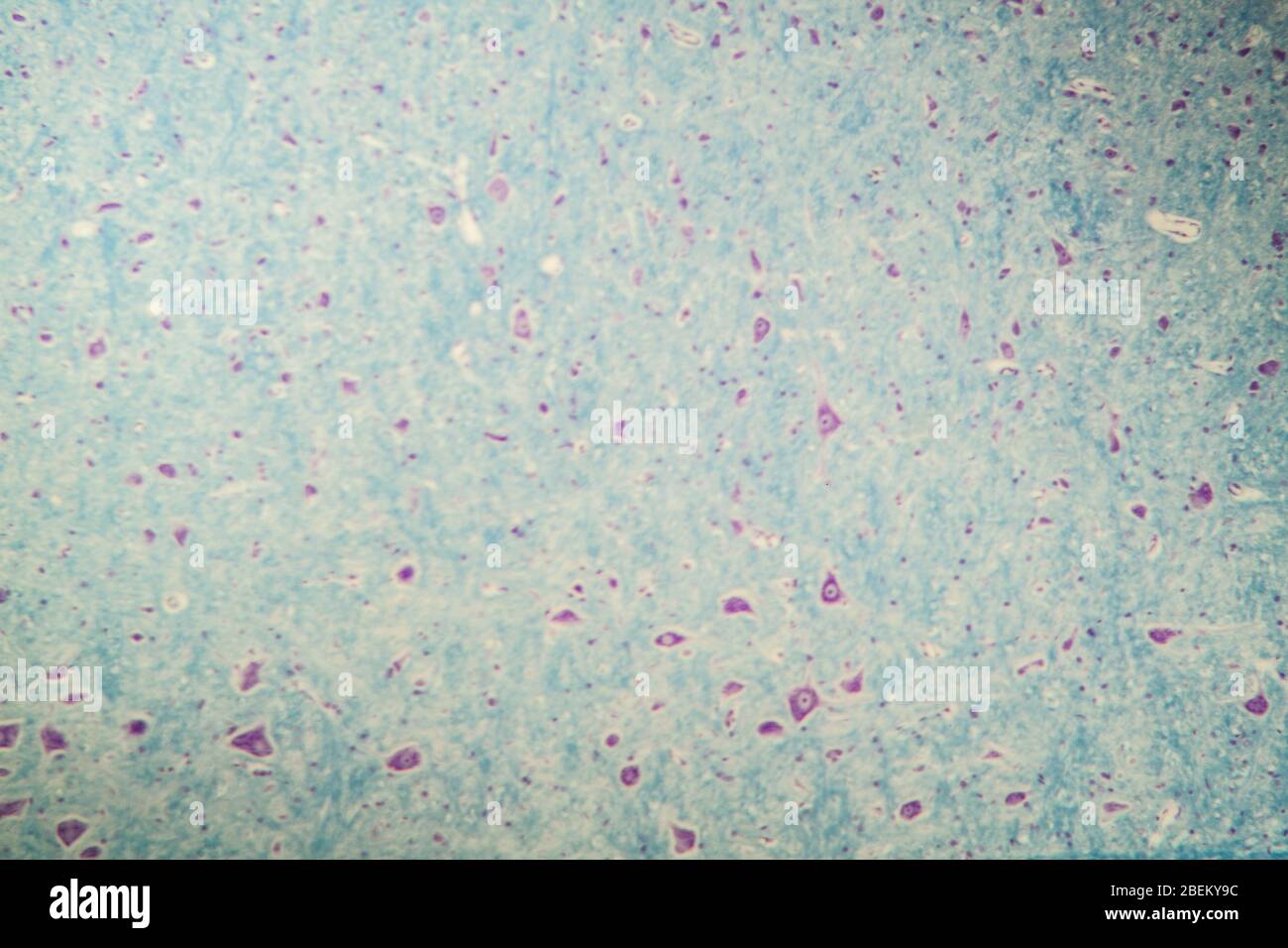 Nerve cells under the microscope 100x Stock Photo - Alamy