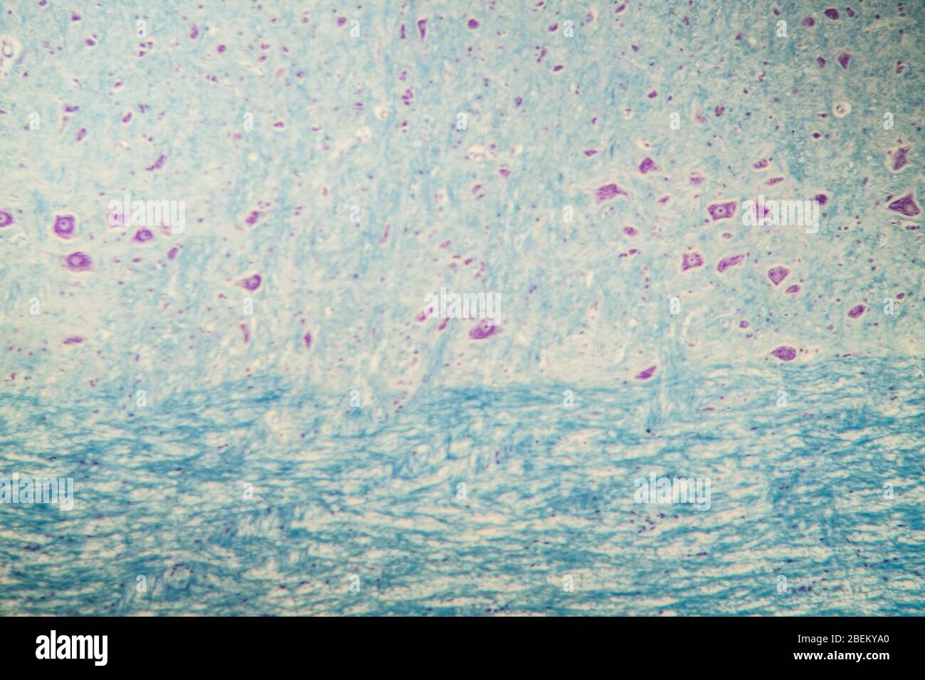 Nerve cells under the microscope 100x Stock Photo - Alamy