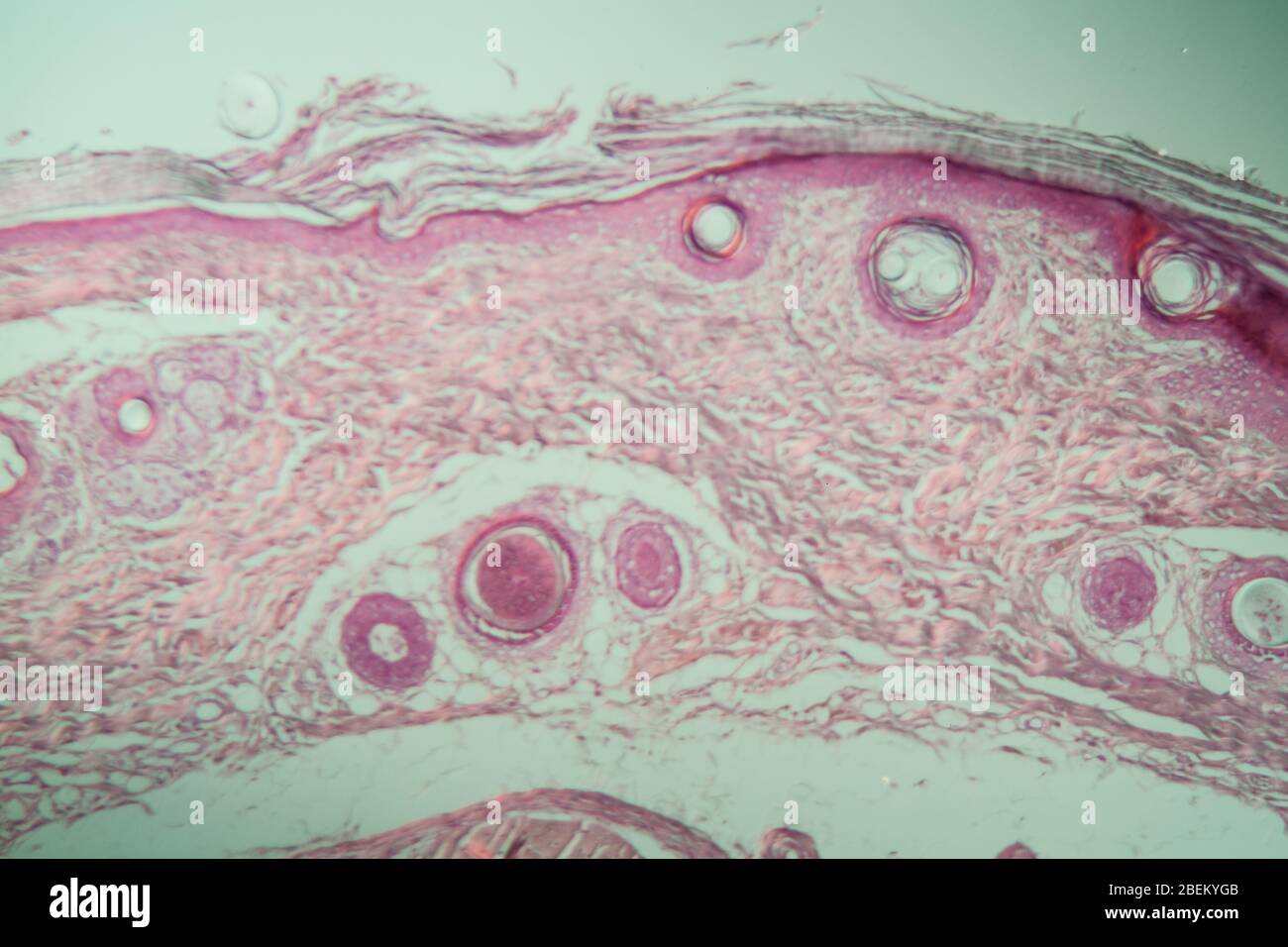 Tail of the rat tissue across 100x Stock Photo - Alamy