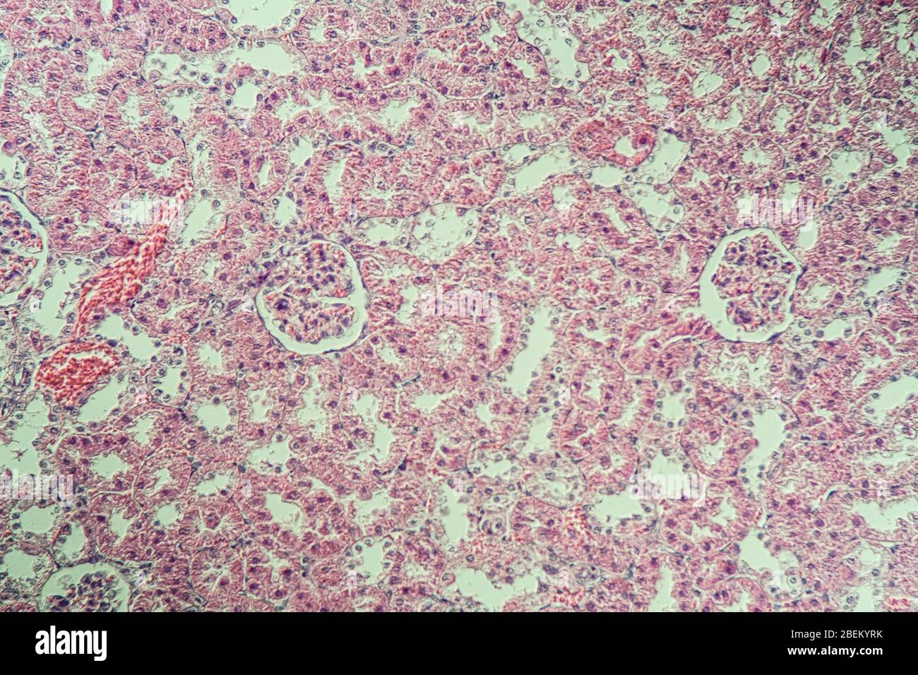 Kidney cortex hi-res stock photography and images - Alamy