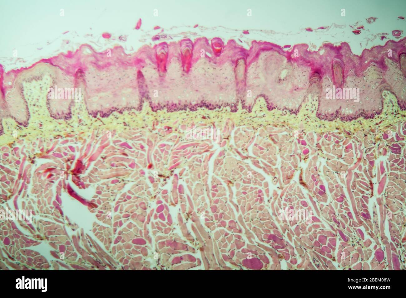 Tongue Tissue with taste buds across 100x Stock Photo - Alamy