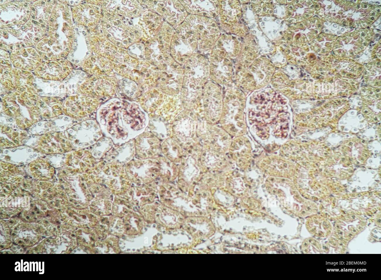 Kidney bowmans capsule hi-res stock photography and images - Alamy