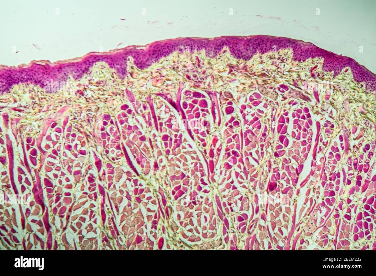 Tongue Tissue with taste buds across 100x Stock Photo - Alamy