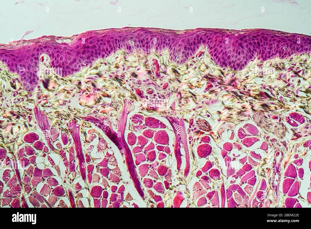 Tongue Tissue with taste buds across 200x Stock Photo - Alamy