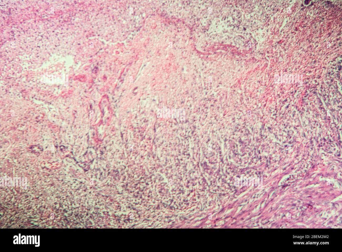 Microscopic Gallbladder