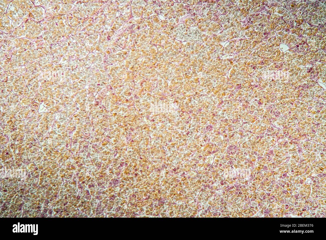 Pituitary gland under the microscope 100x Stock Photo - Alamy