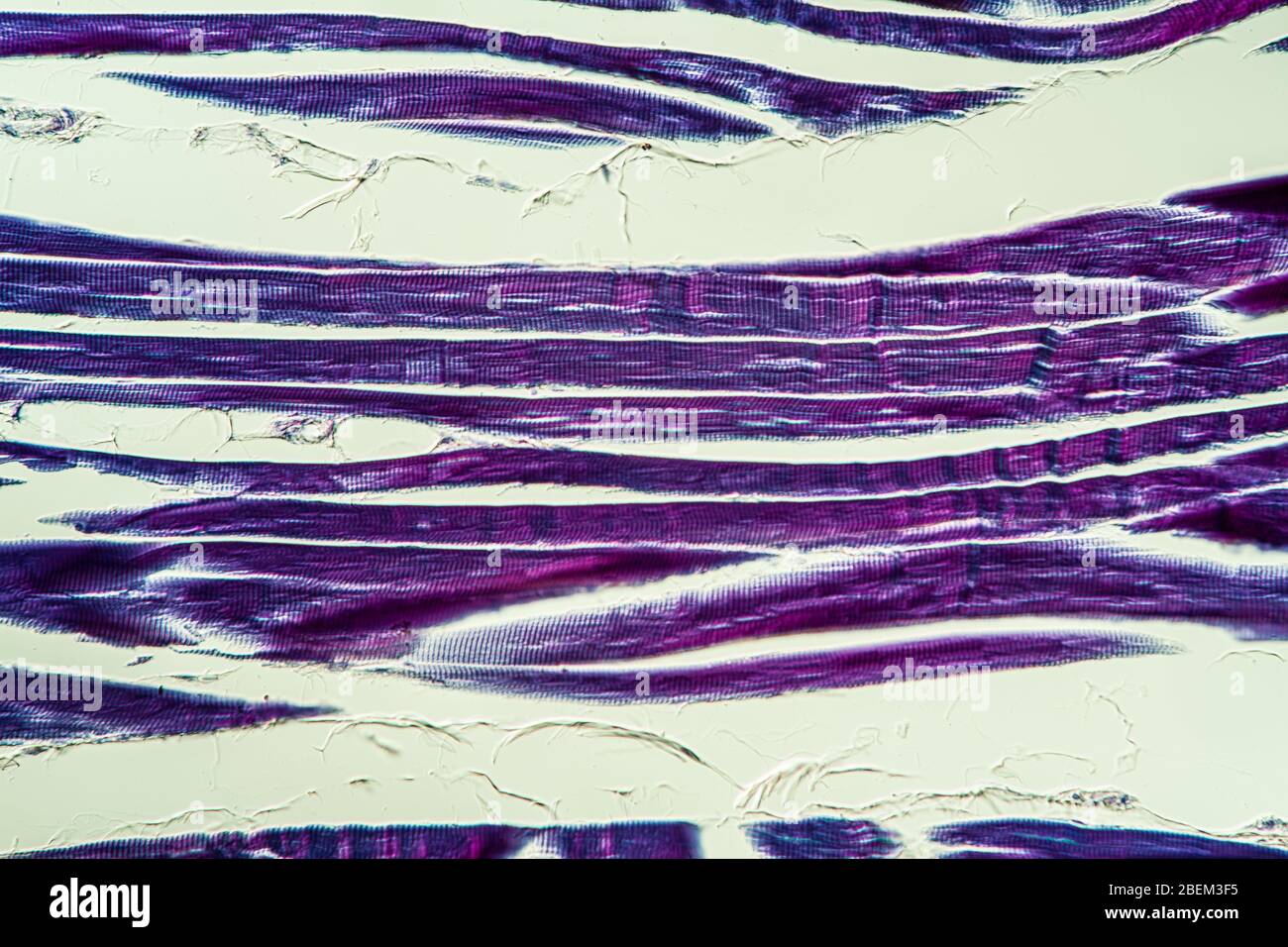 Striated muscle hi-res stock photography and images - Alamy