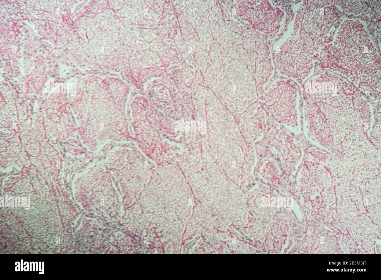 inflamed tissue under the microscope 100x Stock Photo - Alamy