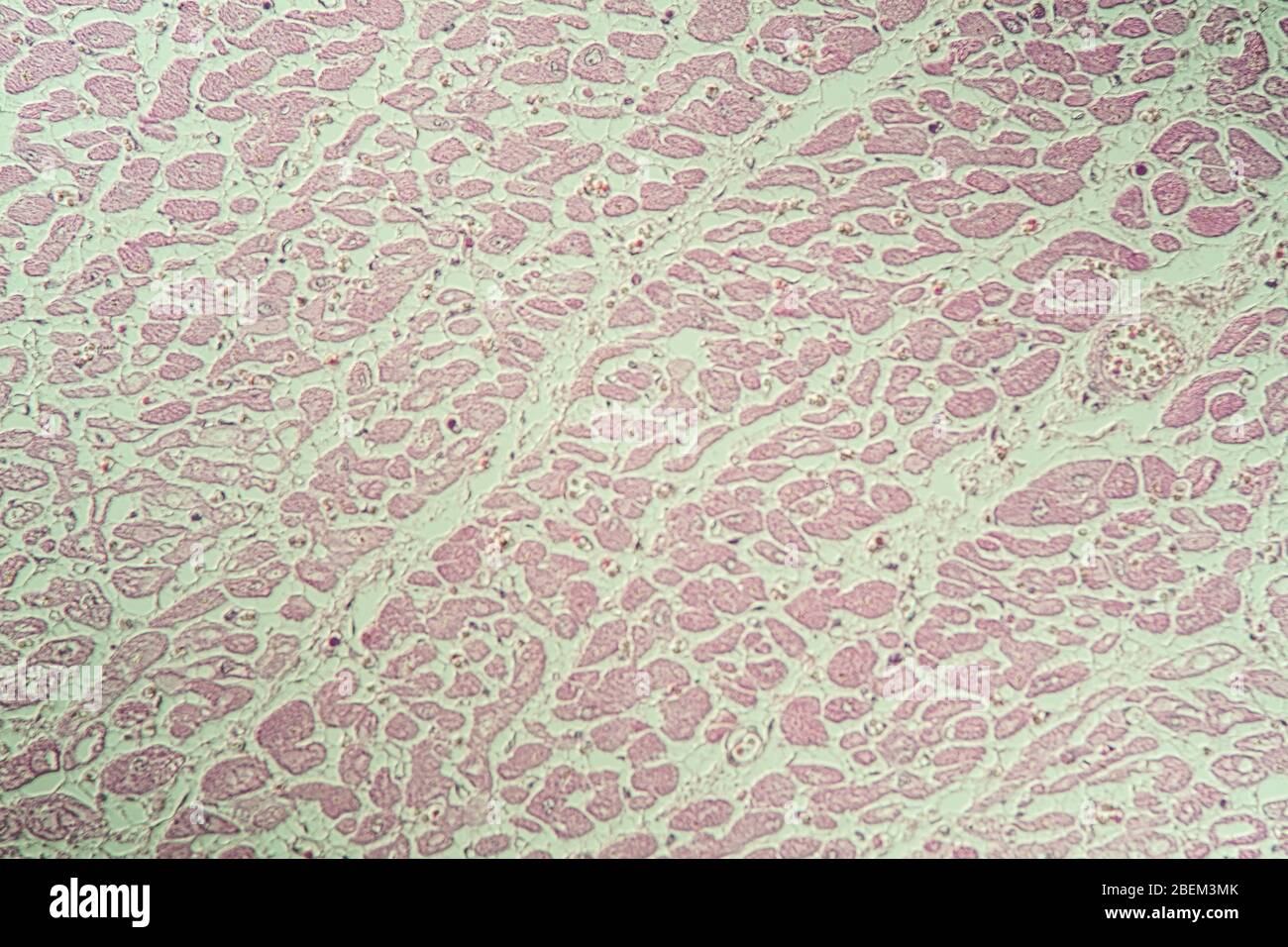 Heart tissue microscope hi-res stock photography and images - Alamy
