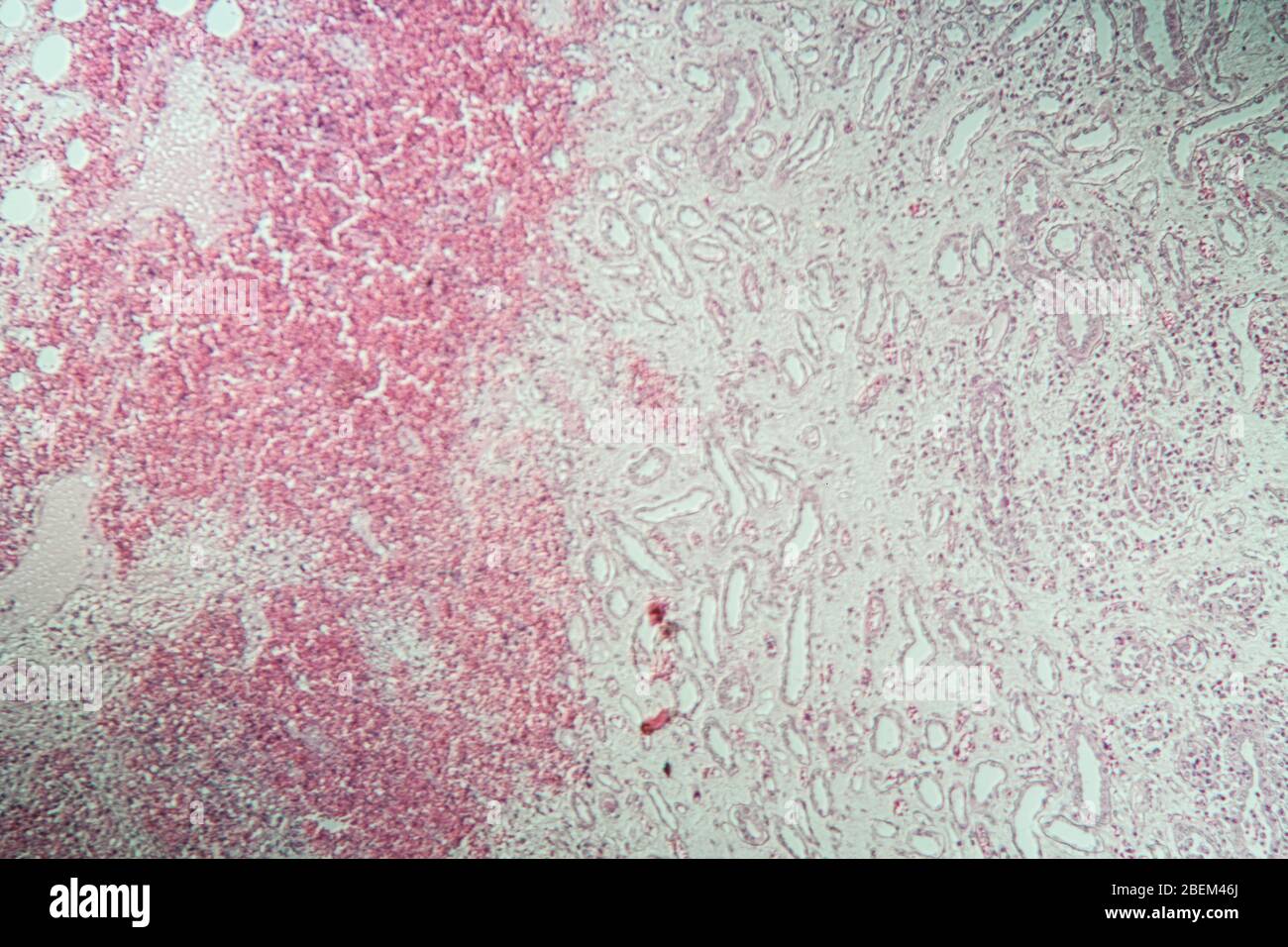 Tissue inflammation microscope hi-res stock photography and images - Alamy