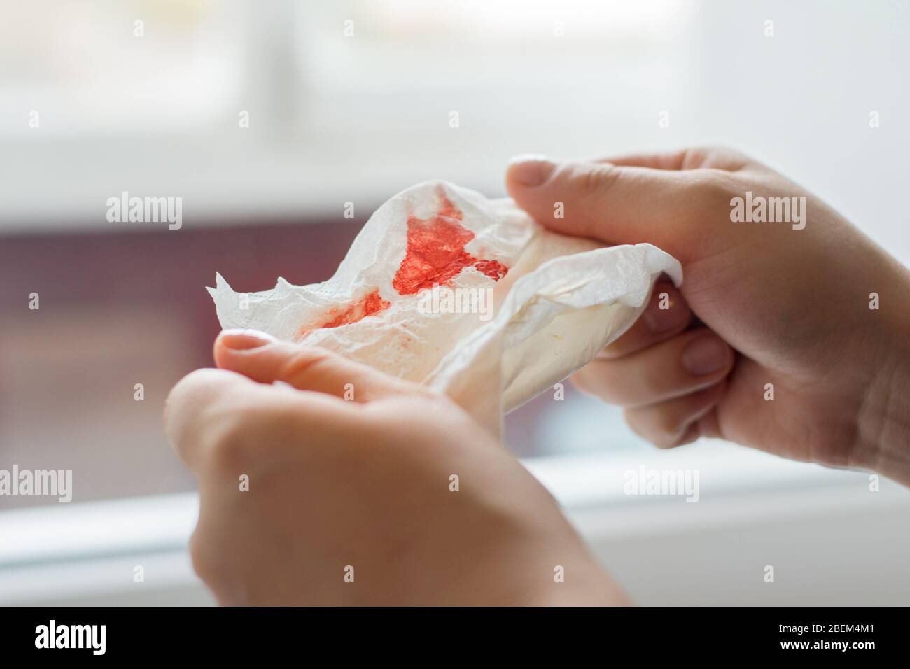 Photo of hands holding a napkin with blood Stock Photo - Alamy