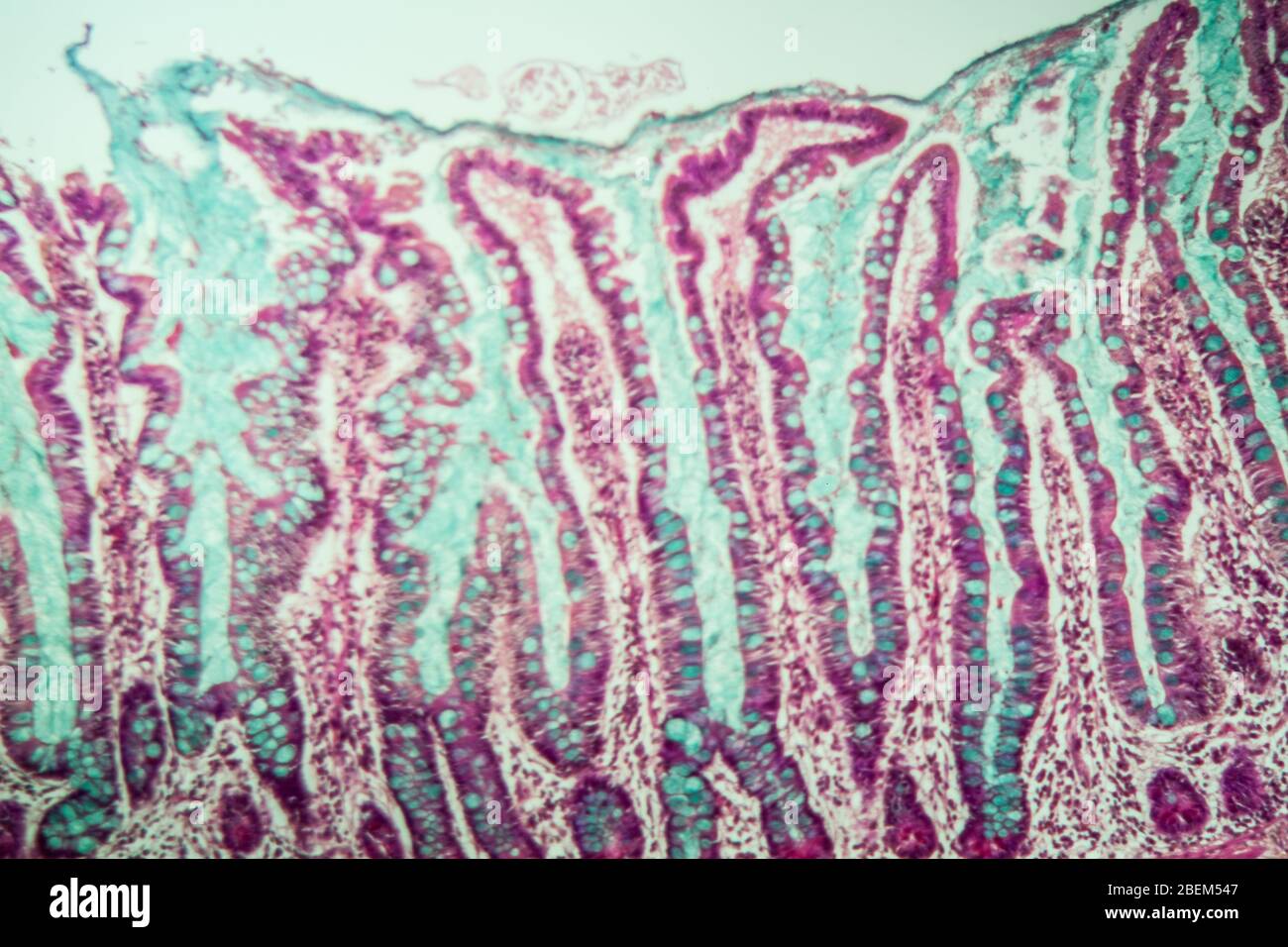 Small intestine with villi under the microscope 100x Stock Photo - Alamy