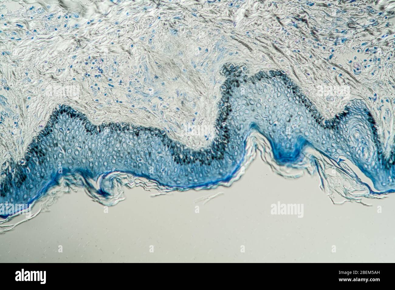 Leprosy skin under the microscope 200x Stock Photo - Alamy