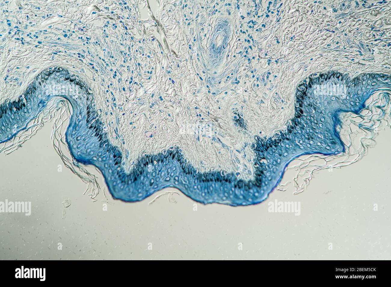 Leprosy skin under the microscope 200x Stock Photo - Alamy