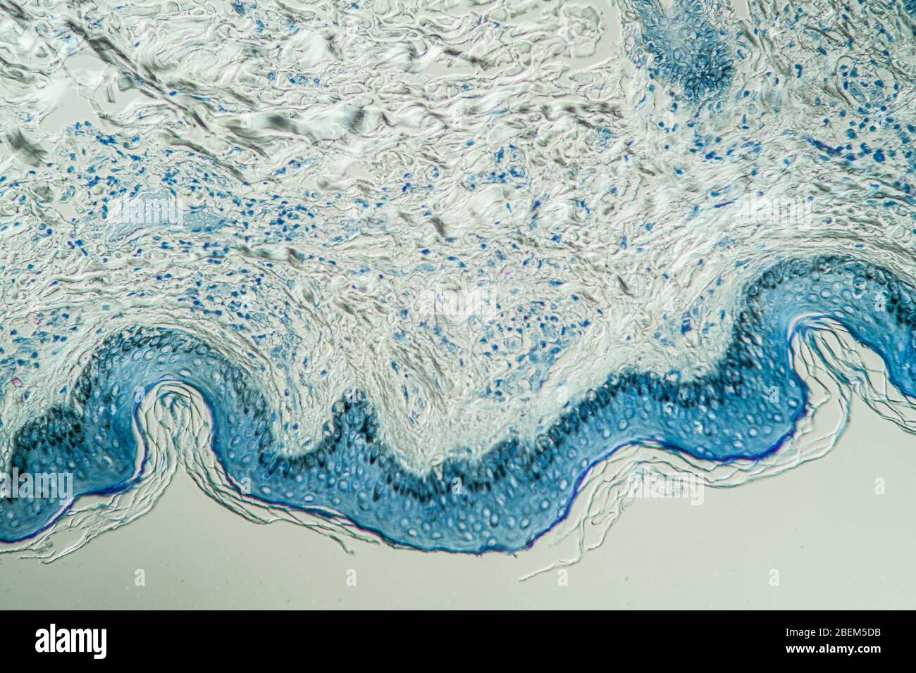 Leprosy skin under the microscope 200x Stock Photo - Alamy