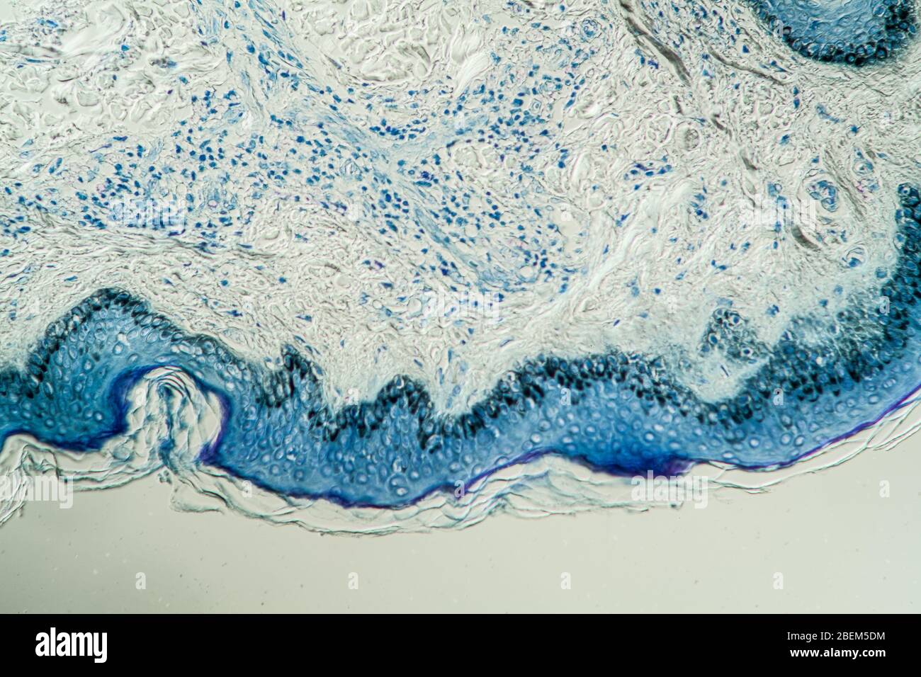 Leprosy skin under the microscope 200x Stock Photo - Alamy