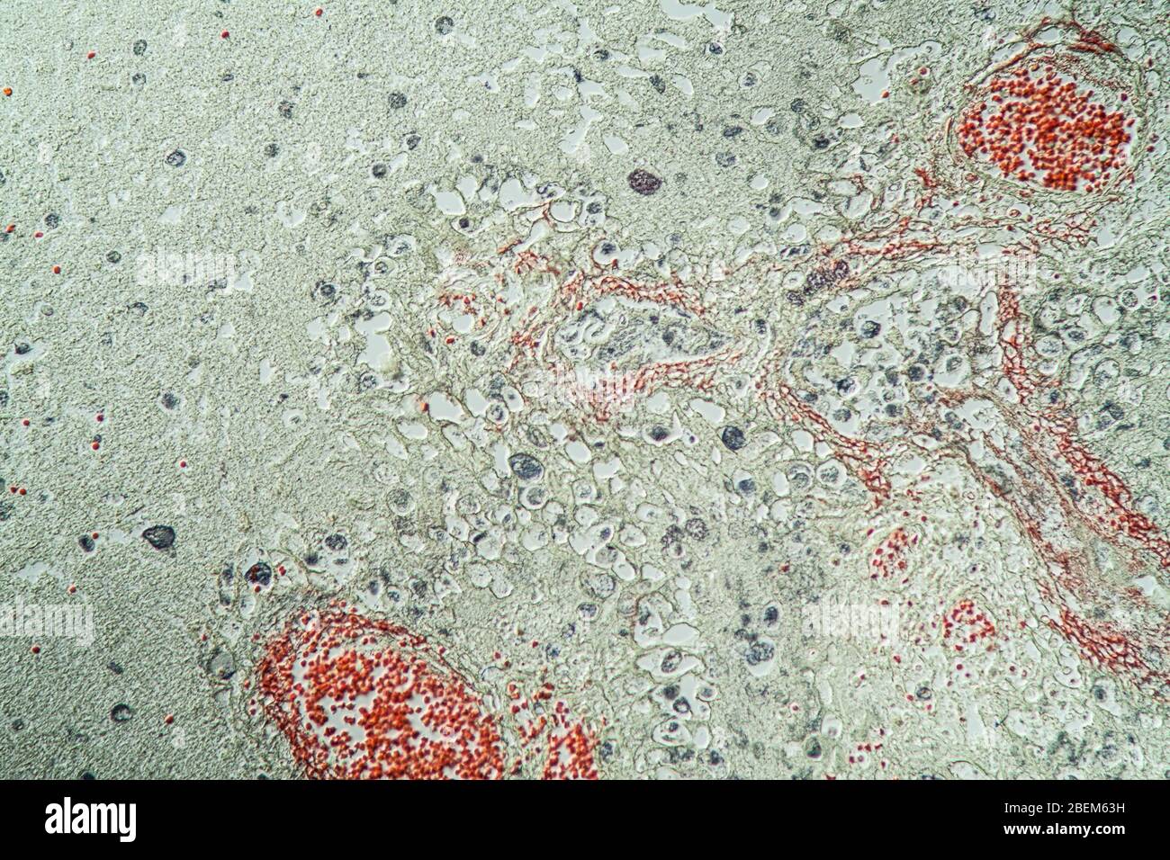 Amoeba parasite tissue under the microscope 200x Stock Photo - Alamy