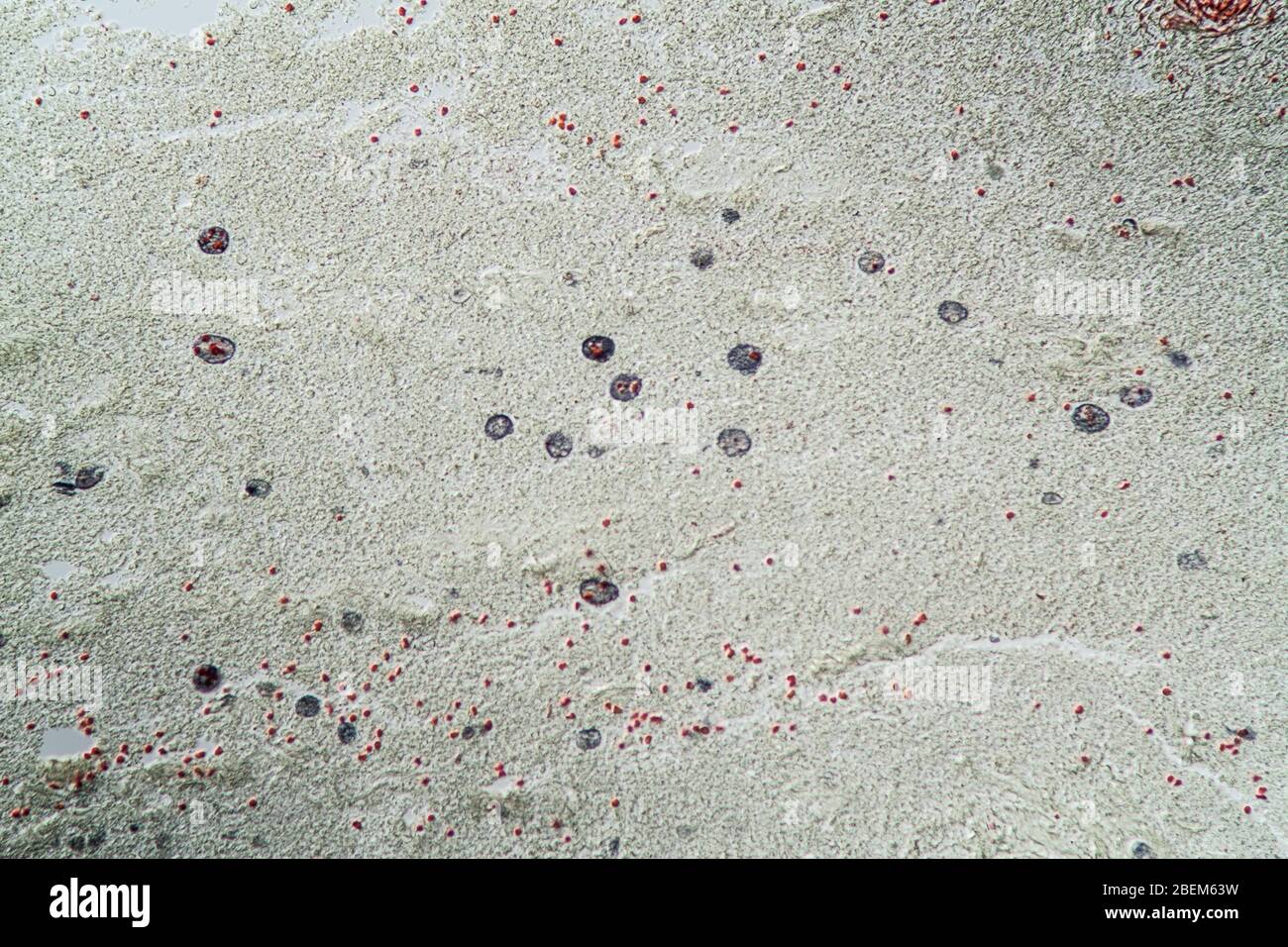 Amoeba parasite tissue under the microscope 200x Stock Photo - Alamy