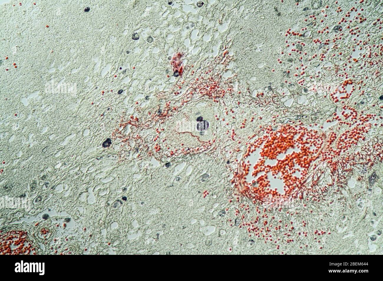 Amoeba microscope hi-res stock photography and images - Alamy